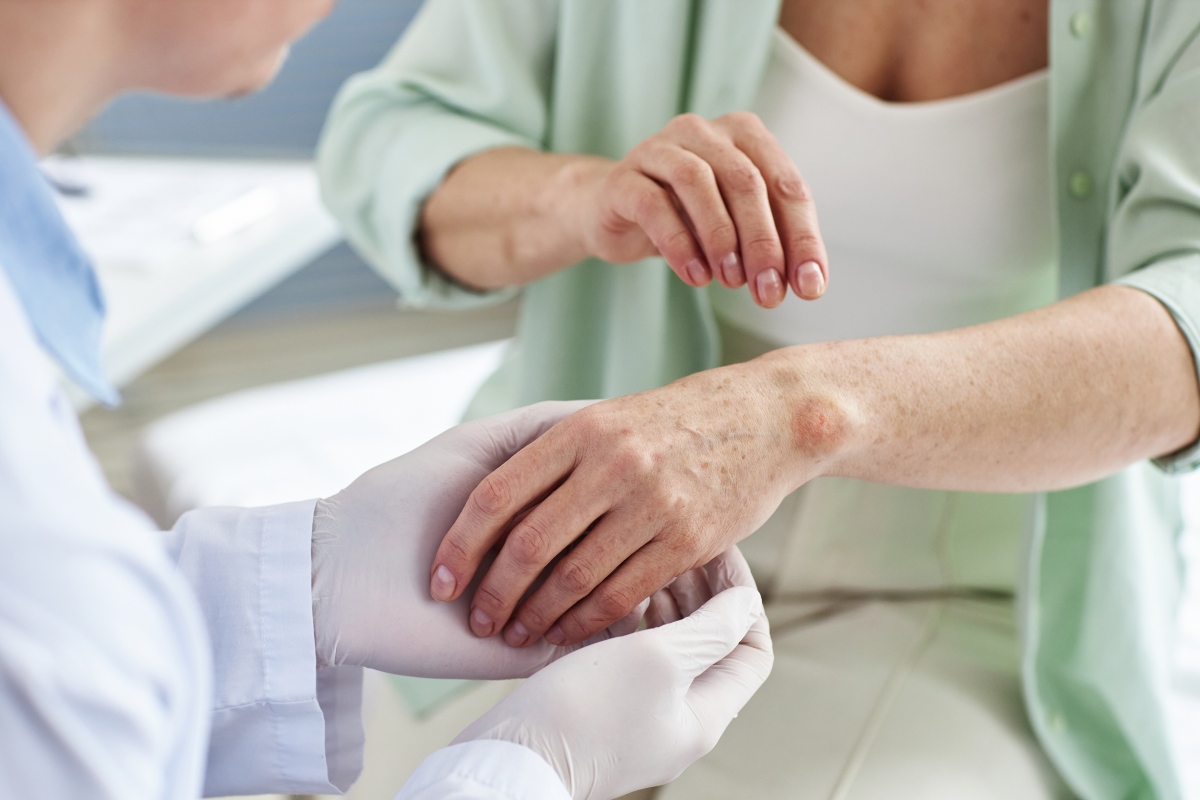 What Makes Ayurveda An Effective Treatment For Psoriasis? - The ...